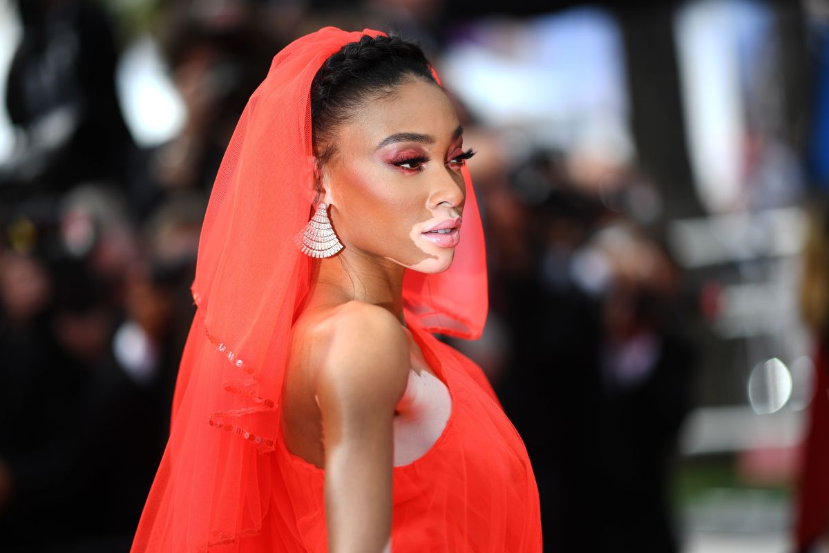 Look: Winnie Harlow's Best Sports Illustrated Swimsuit Photos - The Spun