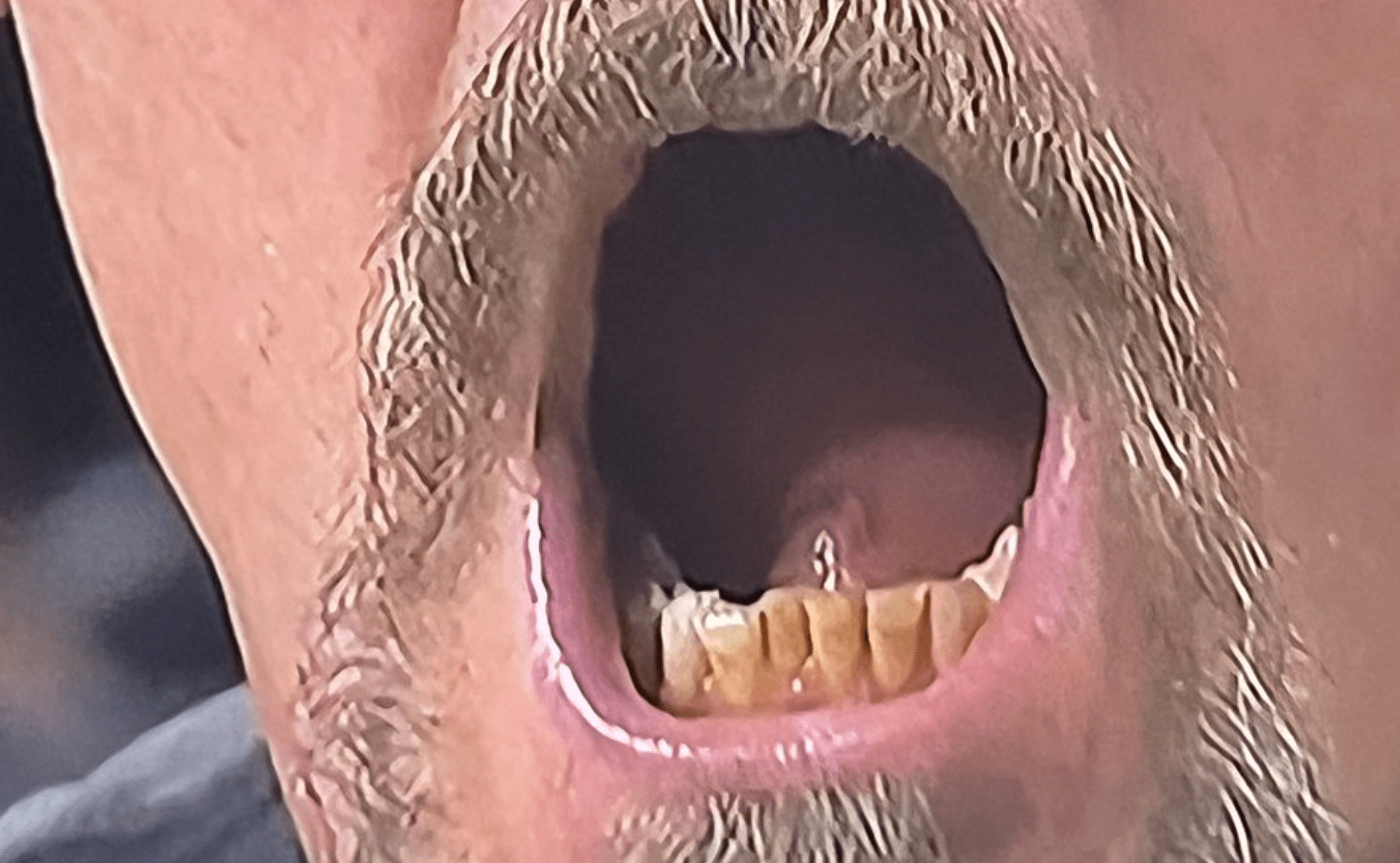 NFL Coach Gets Teeth Whitening Offer After Gross Image Surfaces - The Spun