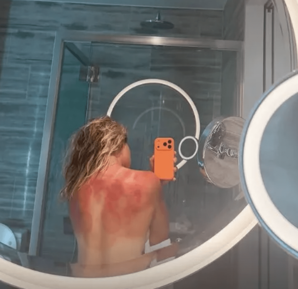 Women's Tennis Star Reveals Painful Australian Open Sun Injury - The Spun